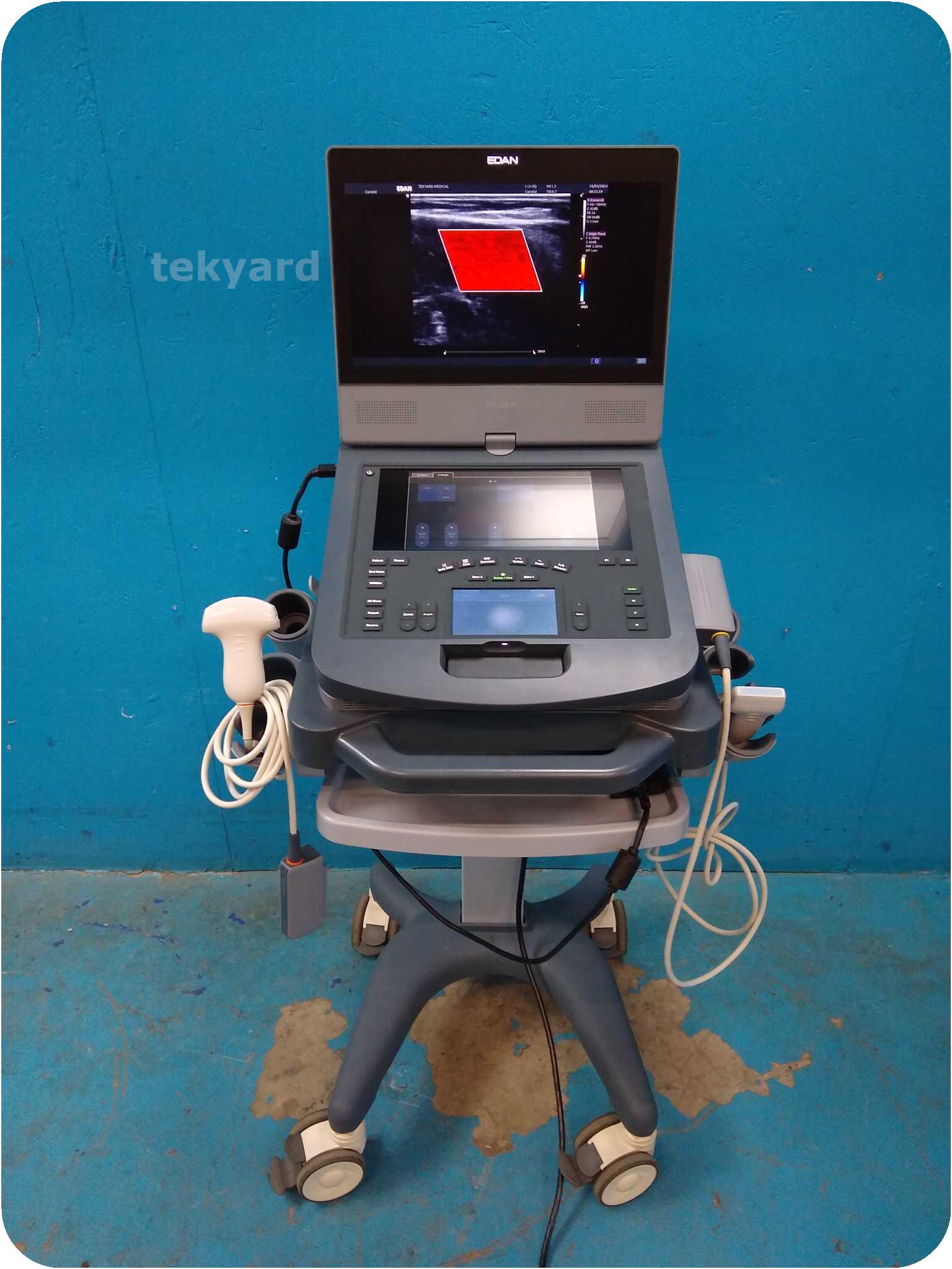 tekyard, LLC. - 328907-Edan Acclarix AX4 Portable Ultrasound System