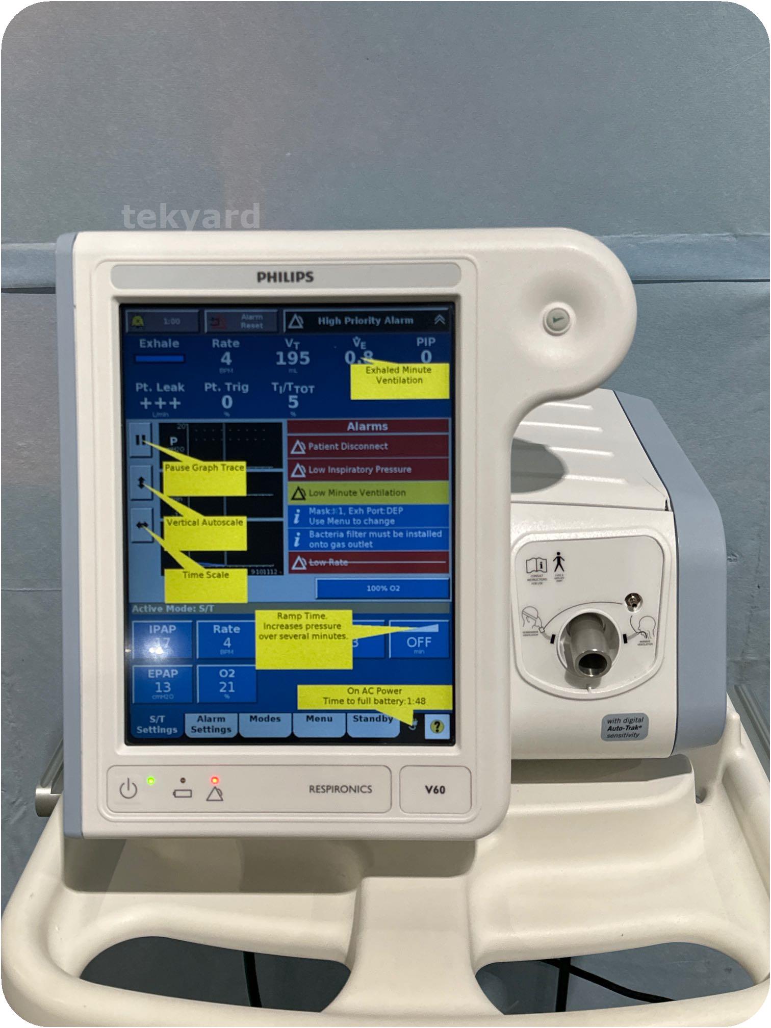 tekyard, LLC. - 349363-Philips / Respironics V60 Ventilator